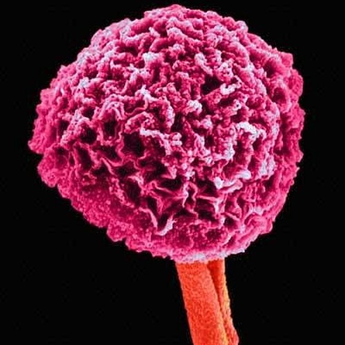 Stream The Mould - Ghetto (Crazy Kazoo Horror Remix) by CrazyKazoo ...