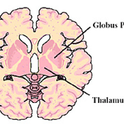 Stream Globus Pallidus (internal segment) by continent | Listen online ...