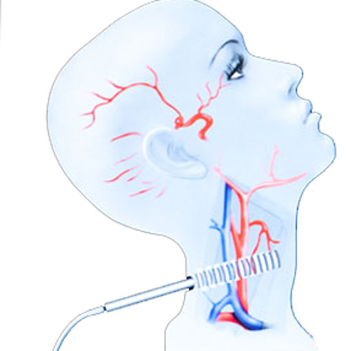 Stream Manu Kenton feat. Dillon - access to Thirteen thirtyfive (DANIEL ...