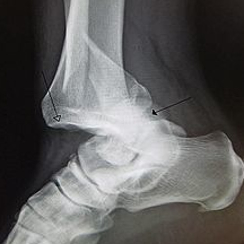 Stream Dislocated Joint by Mikke | Listen online for free on SoundCloud