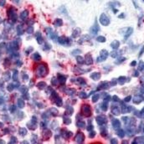 Stream Pirupala - Attractin (Original Mix ) by Penti Gyuszika (Pirupala ...