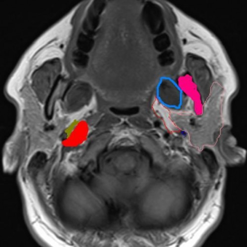 Stream Styloid Process by Boom Human | Listen online for free on SoundCloud