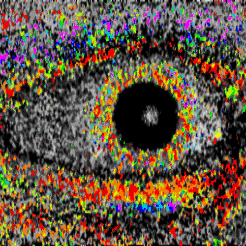 Stream Static Vision by Danny q | Listen online for free on SoundCloud