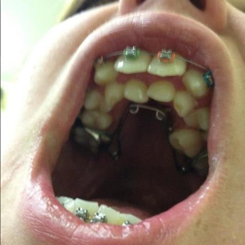 "The Tooth Fairy" (SCP-478 reading) by The Last Glitchling | Free ...