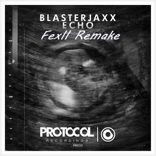 Stream Echo BlasterJaxx - Remake By [FexII] - by StromeX Aka. Elias ...