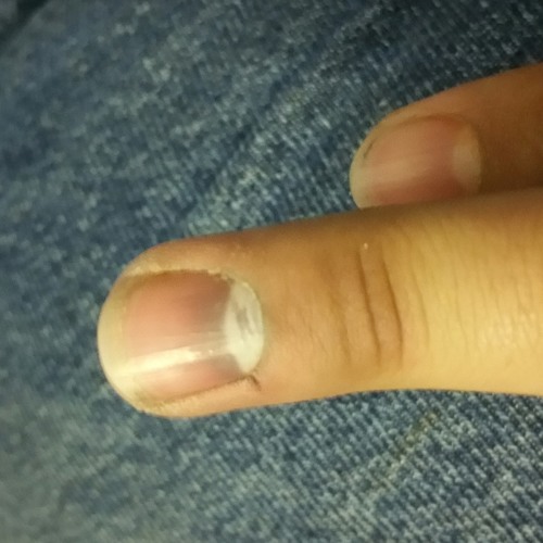 Stream Trying to play with a jammed finger at Stevie ray vaughan by ...