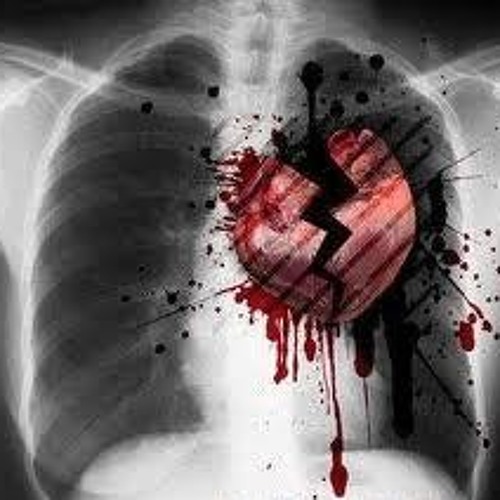 Stream Me Duele El Corazon - Colombia - ImperioMuzik by ImperioMuzik ... Stream Me Duele El Corazon - Colombia - ImperioMuzik by ImperioMuzik ...