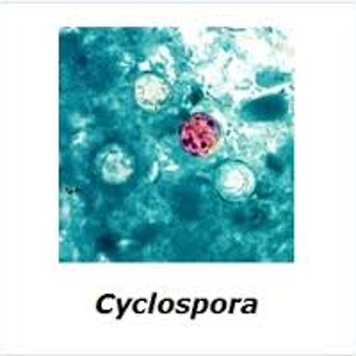 Stream Cyclospora spp by ANA FDA. NICOLA | Listen online for free on SoundCloud