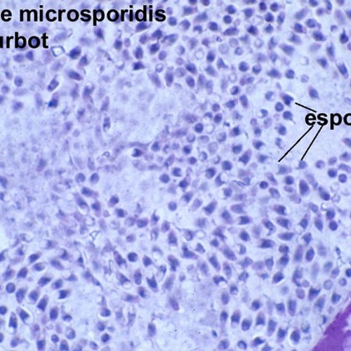 Stream Microsporidium spp. by NataliaPerezM18 | Listen online for free ...