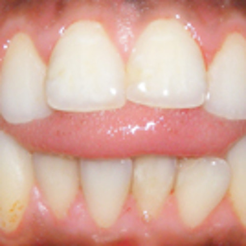 Stream Tongue Between Teeth: /θ/, /ð/ by Farrah Littlepage | Listen ...