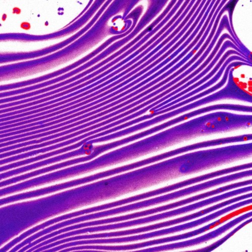 Stream RSN009 - J. Tijn - Infuse EP w/Pris & Skee Mask Remixes by Resin ...