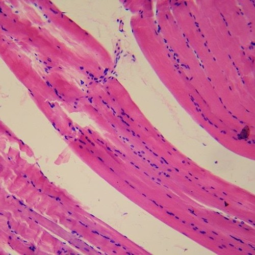 Stream Célula Muscular Lisa by User 233964121 | Listen online for free ...