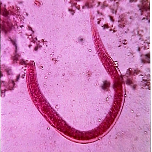 Parasites In Your Lungs (Coughing Up Egg Sacs) rough grind demo by ...