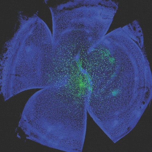 Stream Cornea-copia by Pitt Medcast | Listen online for free on SoundCloud