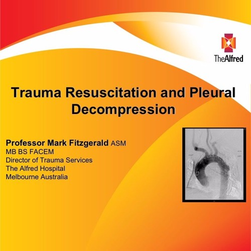 Stream 2014 ASM: Trauma Resuscitation and Pleural Decompression — Prof ...
