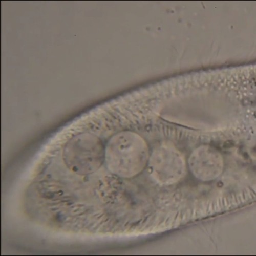 Paramecium Caudatum Under A Microscope 400x
