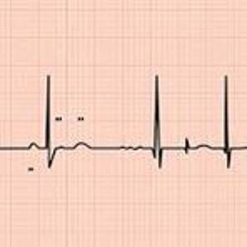 Stream SHUT THE BLOODCLAT (FROM THE VAULTS) by CENSORED RECORDS/ DJ ...