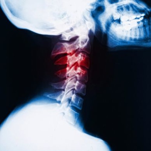 Stream Lose the Back Pain | Listen to Five Hidden Causes of Back ...