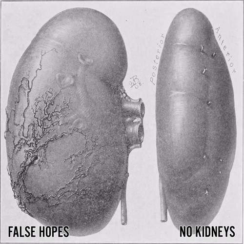 Stream No Kidneys by False Hopes | Listen online for free on SoundCloud