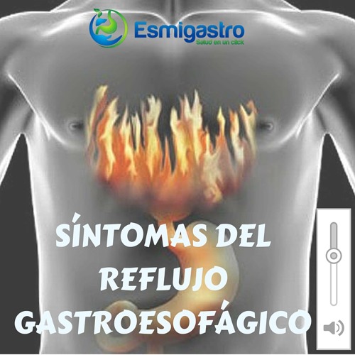 Stream Síntomas del reflujo gastroesofágico by Esmigastro | Listen ...