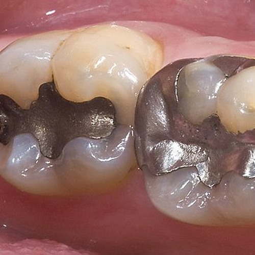 Stream plombe devedesetih by britni | Listen online for free on SoundCloud