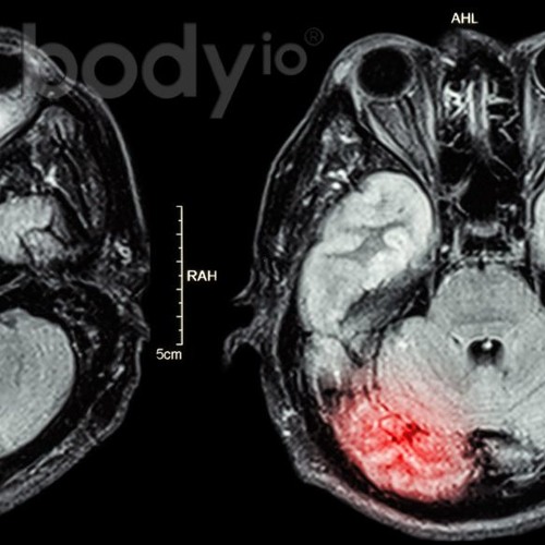 Stream GYMLAIRD 06 - Dr. Tim Rogers - Brain Injury and Stress ...