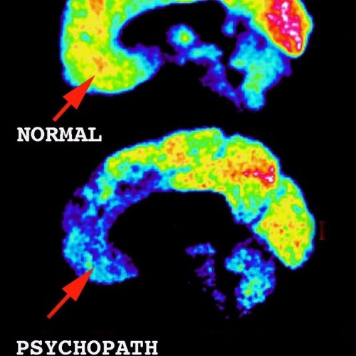 Stream episode Ep. 23 Jim Fallon and the Psychopaths, Part 1 by Explain ...
