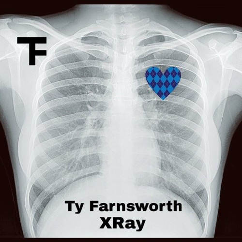 Stream XRay by Ty Farnsworth | Listen online for free on SoundCloud
