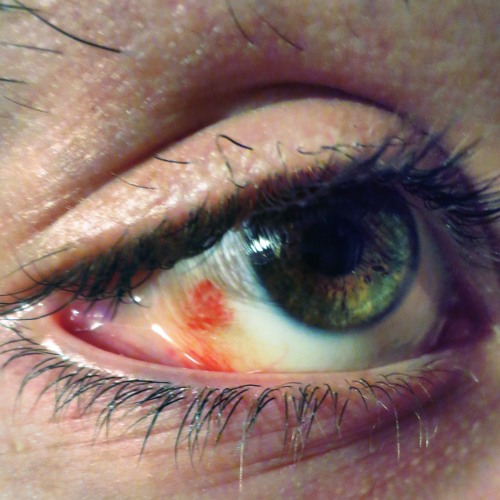 Stream Master Toad - My Body, My Crypt by Master Toad | Listen online ...