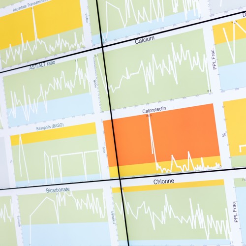 Stream episode n=15 Quantified Surgery: 3D models personalize ...