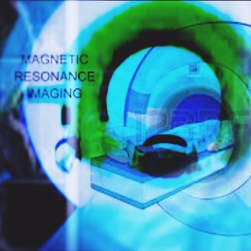 Stream episode Timmy Techno - The MRI Song by Timmy Techno podcast ...