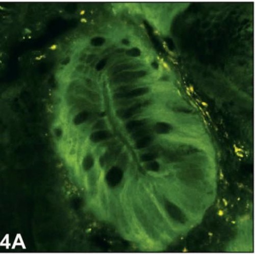 Stream episode Why (and How) Young Pathologists Can Lead In Vivo ...