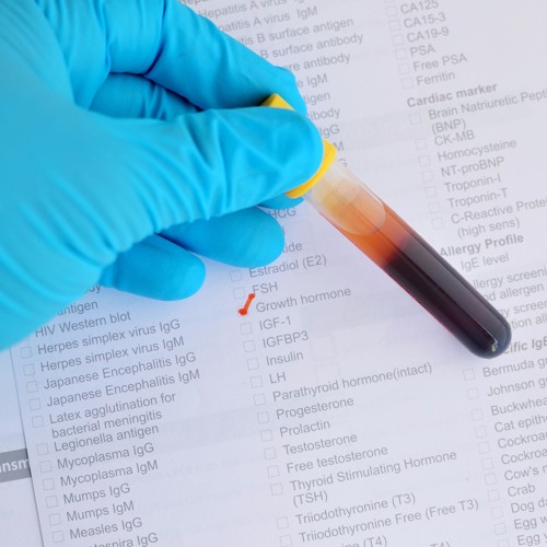 Stream What To Do With Bad Lab Results by Dr. Wendy Sue Swanson ...