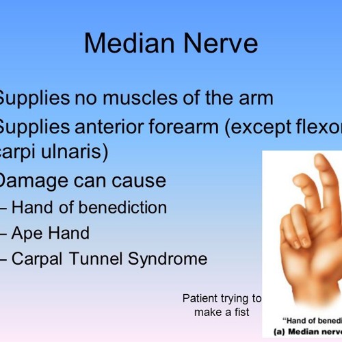 Stream Median nerve compression treatment.mp3 by The Fitzmaurice Hand ...