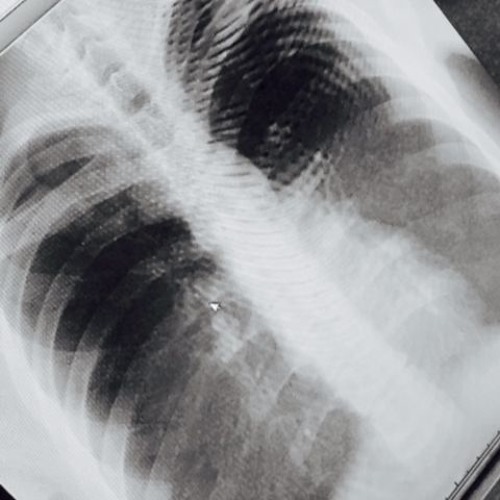 Stream Detroit Storm Lightning by ueno kouta | Listen online for free ...