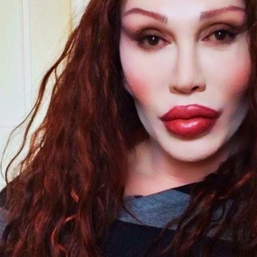 Pete Burns Lips