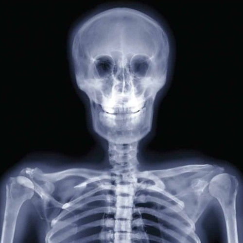 Stream episode How to Tell Your Friend There is a Skeleton Inside Him ...