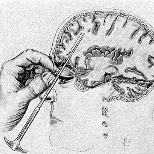 Stream Lobotomía Transorbital by A M P L E X O | Listen online for free ...