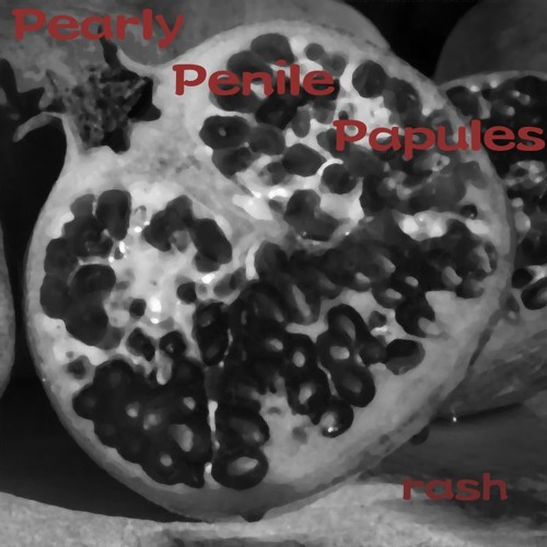 Stream Pearly Penile Papules - rash (EP) by Pearly Penile Papules ...