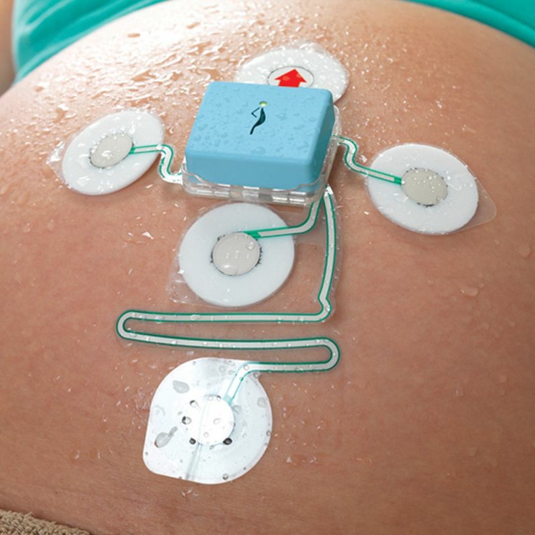 Stream GE Healthcare’s Novii Wireless Patch System by GE Reports Radio ...