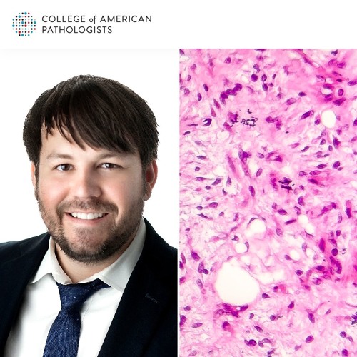 Stream Tackling The Challenges Of Soft Tissue Pathology By Capcasts