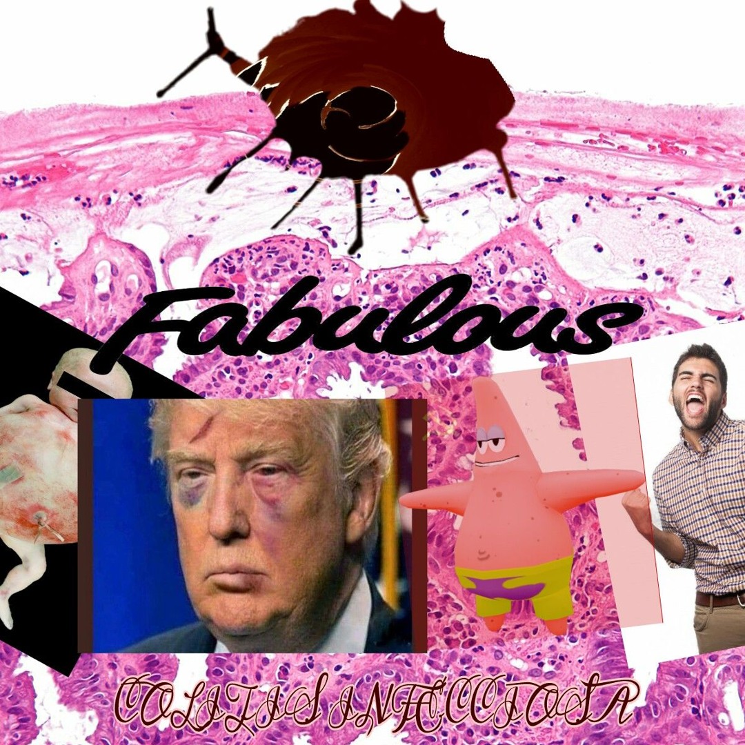 Stream Dr. Vicarius Vonn Cünt | Listen to Uterovaginal Cystitis ...