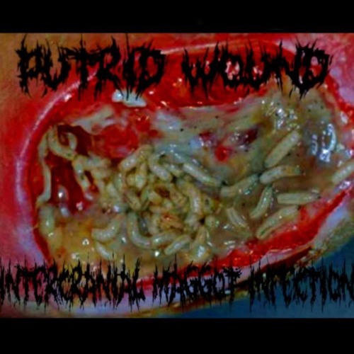 Stream Putrid Wound | Listen to Intercranial Maggot Infection playlist ...