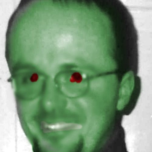 Stream Bochhammerautismus by Brett Peet | Listen online for free on ...