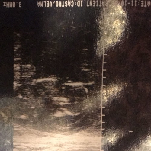 Stream Demos Listen To Demos And Pretty Messes Playlist Online For