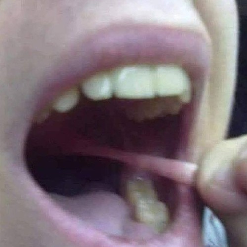 Ooooooooooooooooooooooo