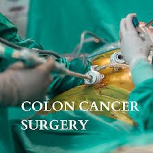 Stream Colorectal Cancer Insights From Singapore by Crest Surgical ...