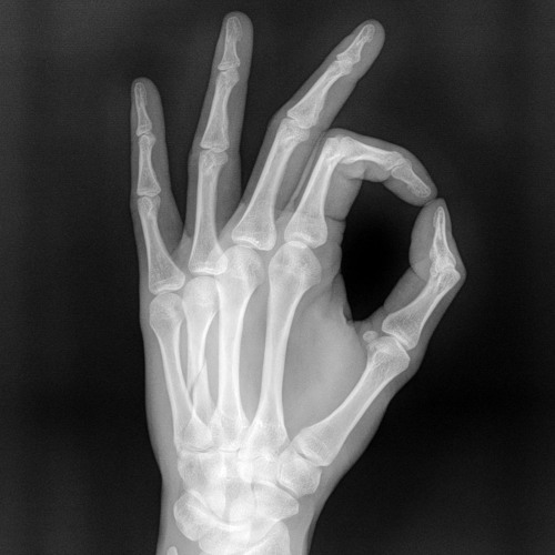 Stream BREAK SOME BONES | HEAVY DUB MIX by Mudbutt | Listen online for ...