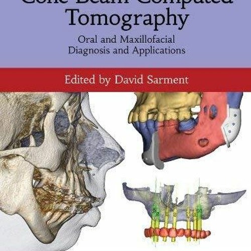 Stream Episode [pdf] Cone Beam Computed Tomography Oral And Maxillofacial Diagnosis And