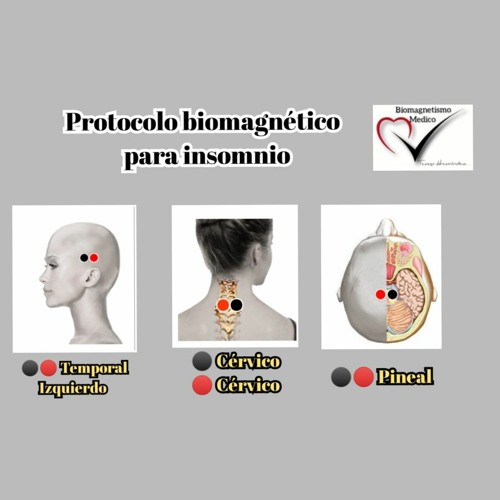 Stream episode BIOMAGNETISMO | Protocolo para reducir el insonmio by ...